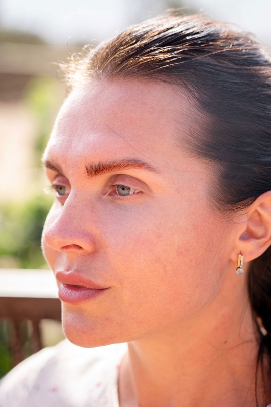 Facial Aesthetics Treatments | Dental House Exeter